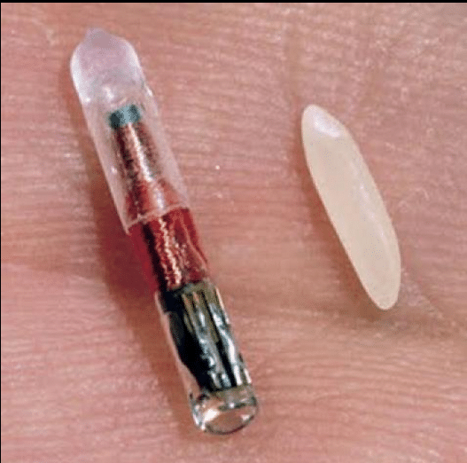 Implications of Identity Chips Implanted Under the Skin - VGamerz